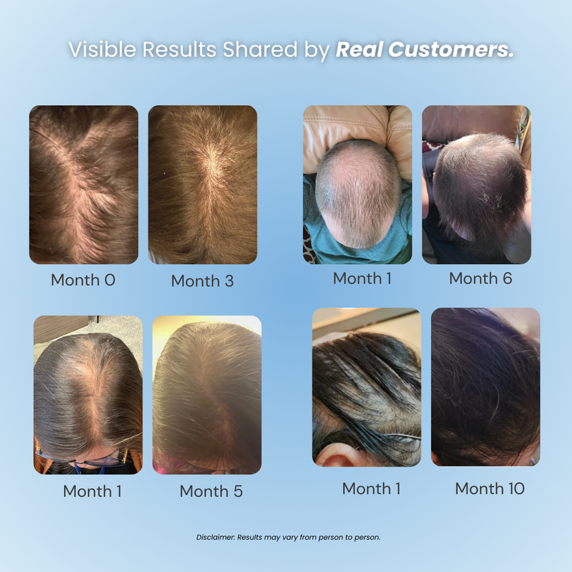 VITAFOAM ™ Hair Growth Formula – Growplex