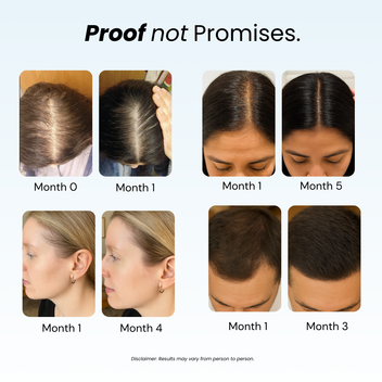 Revive™ Hair Growth Shampoo – Strengthen & Nourish – Growplex