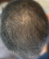 Growplex – Growplex